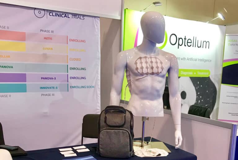 Tumor Treating Fields for mesothelioma: new promising data just ...